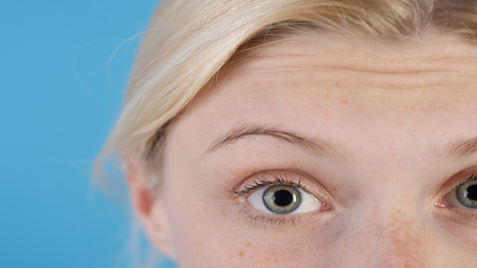 How to Banish Forehead Wrinkles Naturally
