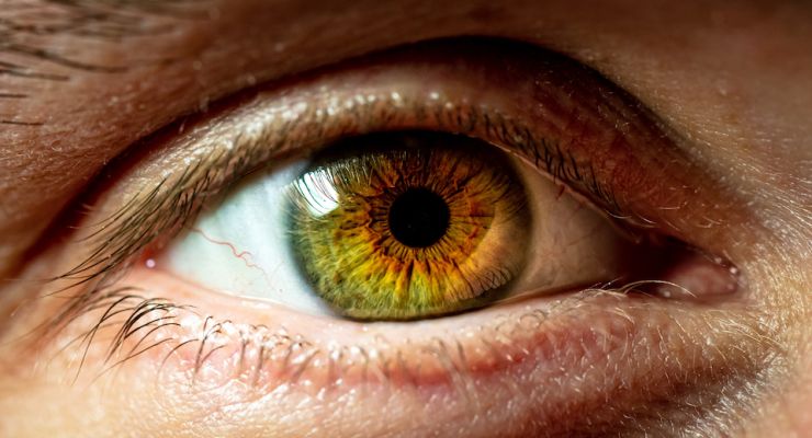 What Are Eye Floaters and Are they Bad?